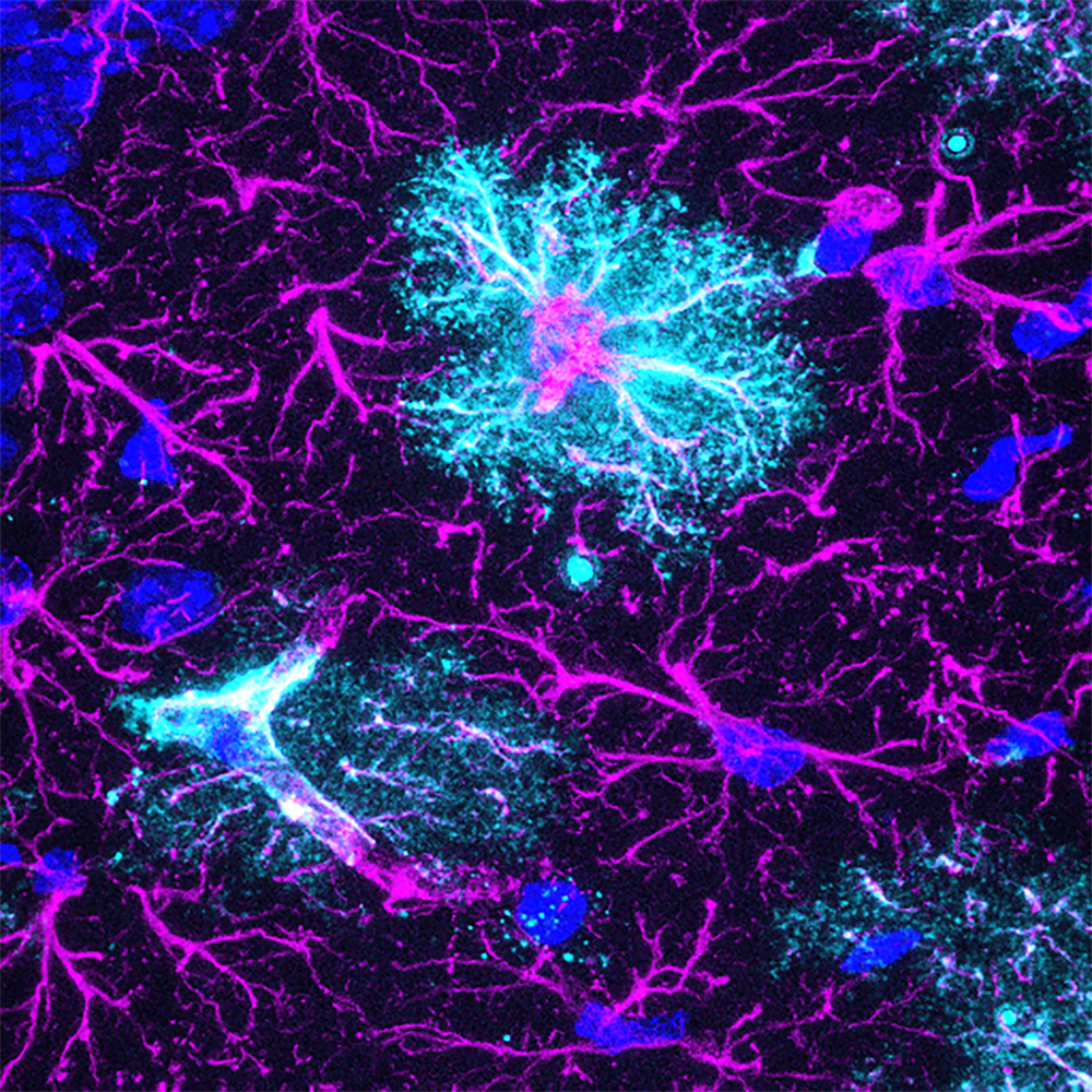 2024 Endocrine Images Award Winners | Endocrine Society