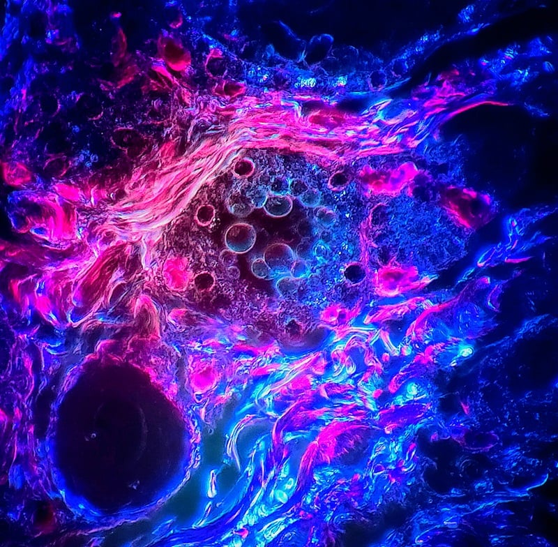 Sriram Gubbi of NIDDK wins Endocrine Society’s 2025 Endocrine Images Art Competition | Endocrine ...