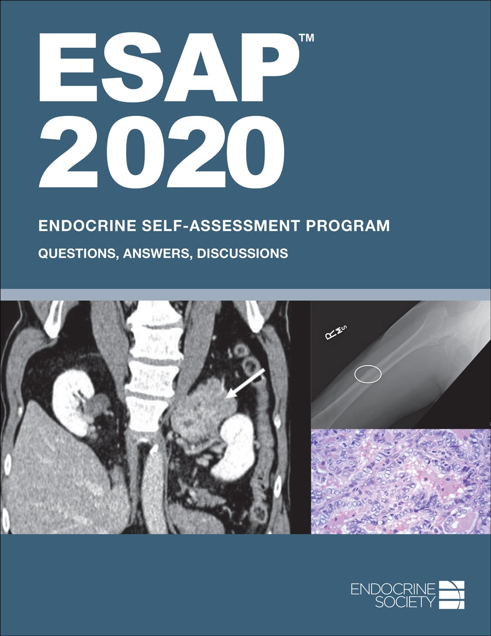 Updates to Endocrine Self-Assessment Program | Endocrine Society