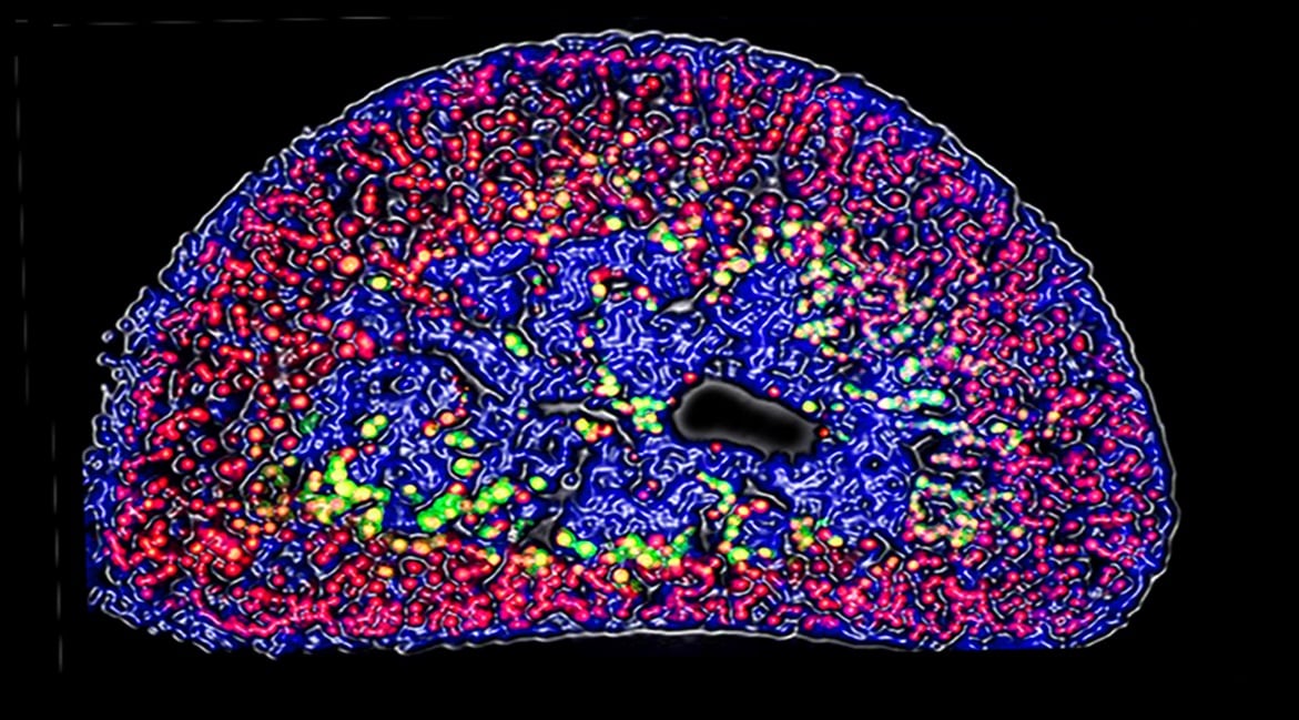Awards | Endocrine Society