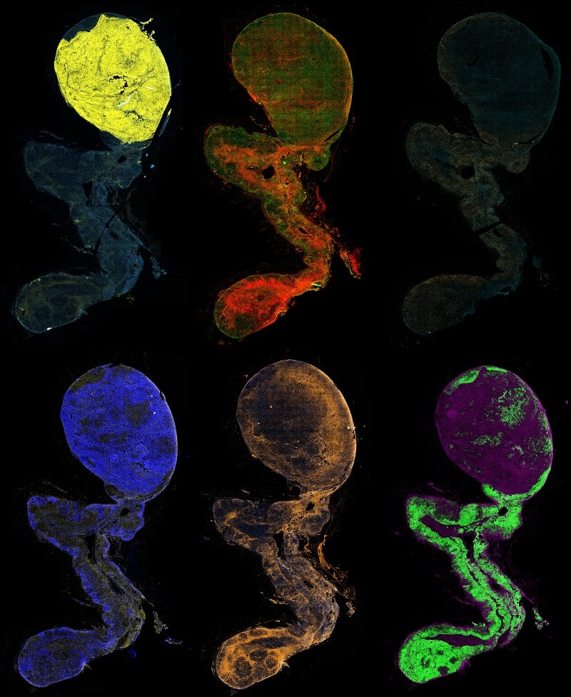 Endocrine Images Award Winners | Endocrine Society