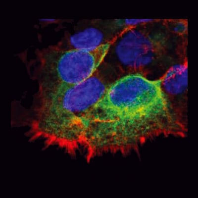 Analysis of Calcium Sensing Receptor Variants | Endocrine Society