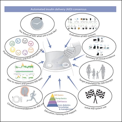 Automated Insulin Delivery Consensus | Endocrine Society