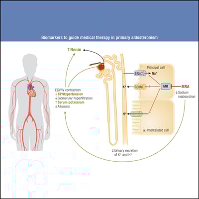 Biomarkers in Primary Aldosteronism | Endocrine Society