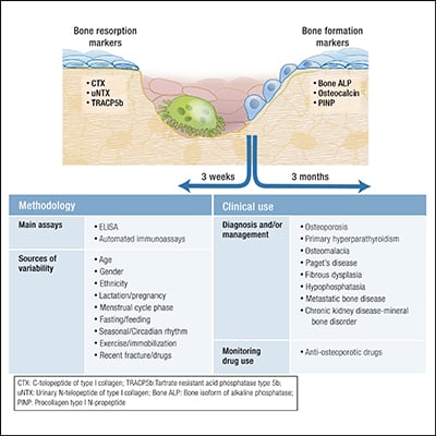 Bone Turnover Markers | Endocrine Society