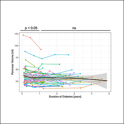 Changes in Pancreas Size and Shape in Type 1 Diabetes | Endocrine Society
