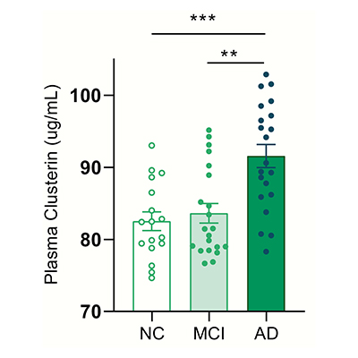 Clusterin in Diabetes and Alzheimer Disease | Endocrine Society