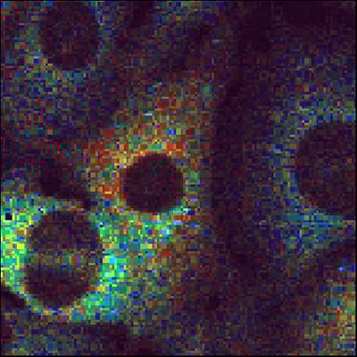 CNP Promotes Endochondral Bone Growth via PKA | Endocrine Society