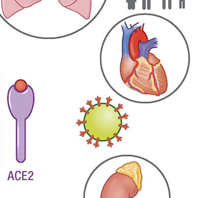 Coronavirus Infections and Type 2 Diabetes | Endocrine Society