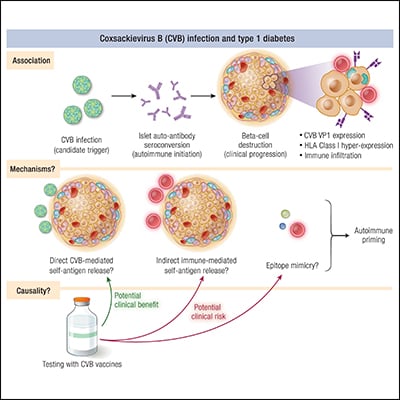 Coxsackievirus and Type 1 Diabetes | Endocrine Society