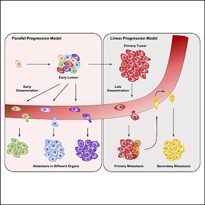 Dissemination of Circulating Tumor Cells in Breast and Prostate Cancer ...