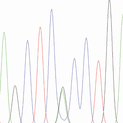Familial Dysalbuminemic Hyperthyroxinemia in Thyroid Function Tests ...