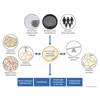Fat Cell Size: Review and Meta-analysis | Endocrine Society