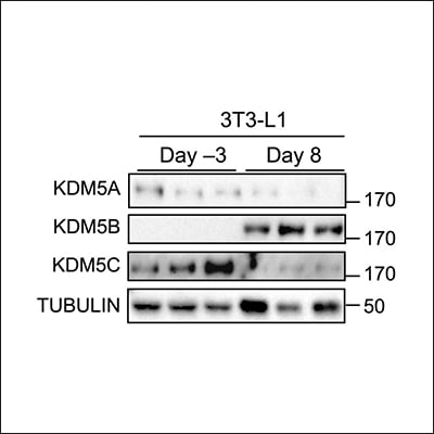 Gene Regulation and Mitochondrial Activity During White and Brown ...
