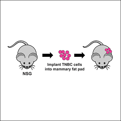 Inhibition of TNBC Progression by ERβ | Endocrine Society