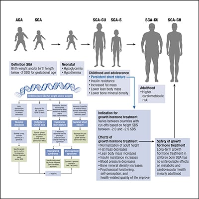 International Consensus Guideline on SGA | Endocrine Society