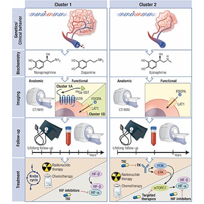 Management of Pheochromocytoma | Endocrine Society