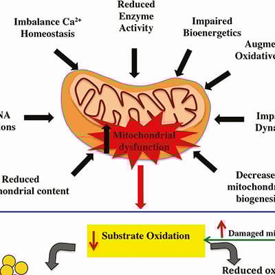 Mitochondrial Dysfunction and Health | Endocrine Society