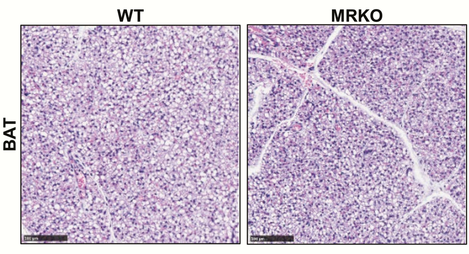 Receptor in Adipogenesis and Obesity | Endocrine Society