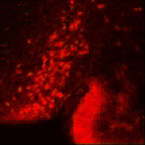 Negative Feedback Loops and Hormonal Factors That Regulate GH Secretion ...