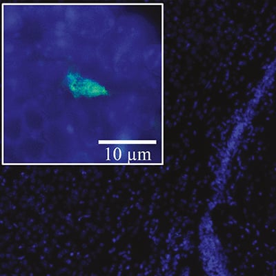 Neuroprotective Effects of rhGH | Endocrine Society