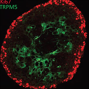 Pig Taste Cell-Derived Organoids Synthesize Insulin | Endocrine Society