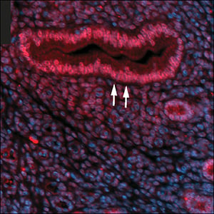 SALL1 Is an Orchestrator of Uterine Receptivity in Part via Titration ...