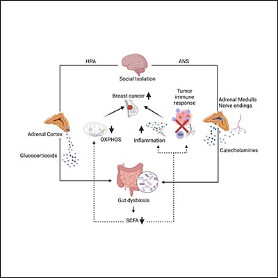 Social Isolation and Breast Cancer | Endocrine Society