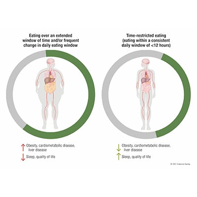 Time-Restricted Feeding for Health Benefits | Endocrine Society
