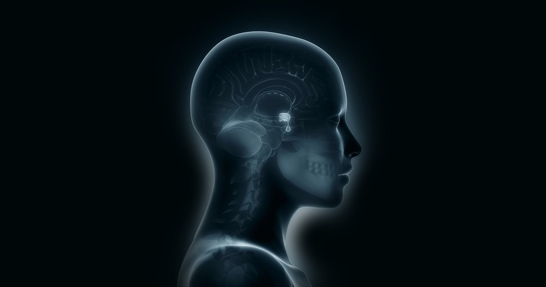 Hypopituitarism | Endocrine Society