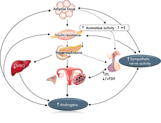 Polycystic Ovary Syndrome | Endocrine Society